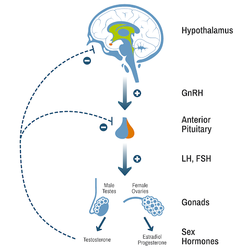 Hypogonadism in Prader‑Willi Syndrome